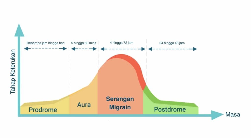 Tanda-tanda Dan Punca Migrain | Regenesis Physiotherapy